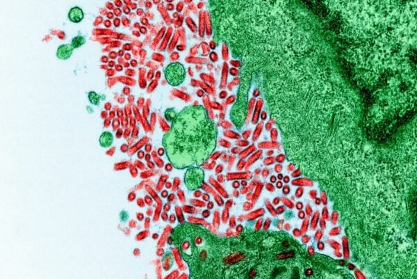 Infectious Diseases - NFID